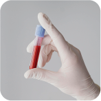 Know everything about the different blood groups