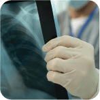 Everything you need to know about lung diffusion test