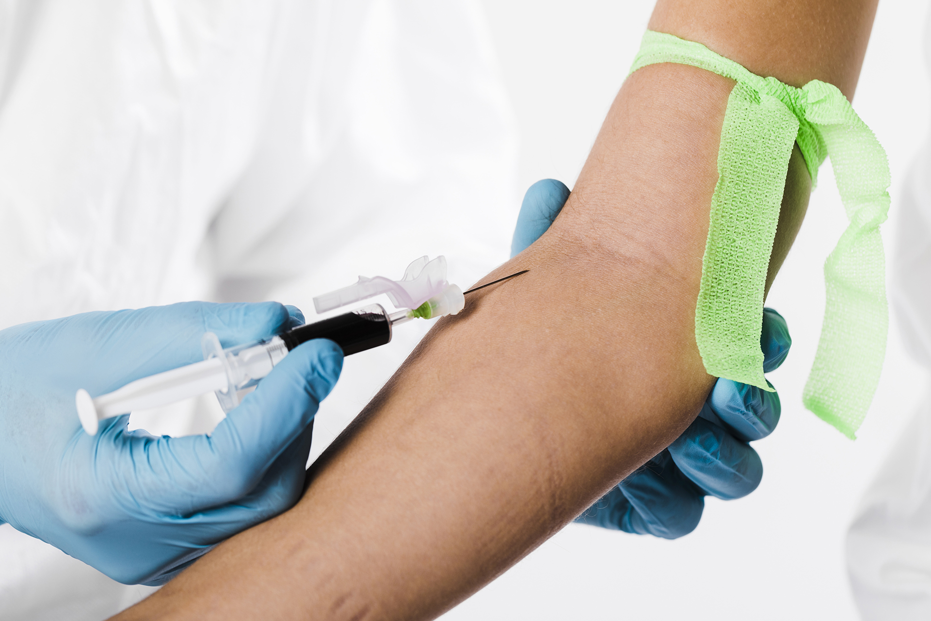 How Is A Lipoprotein A Test Done And What The Result Means