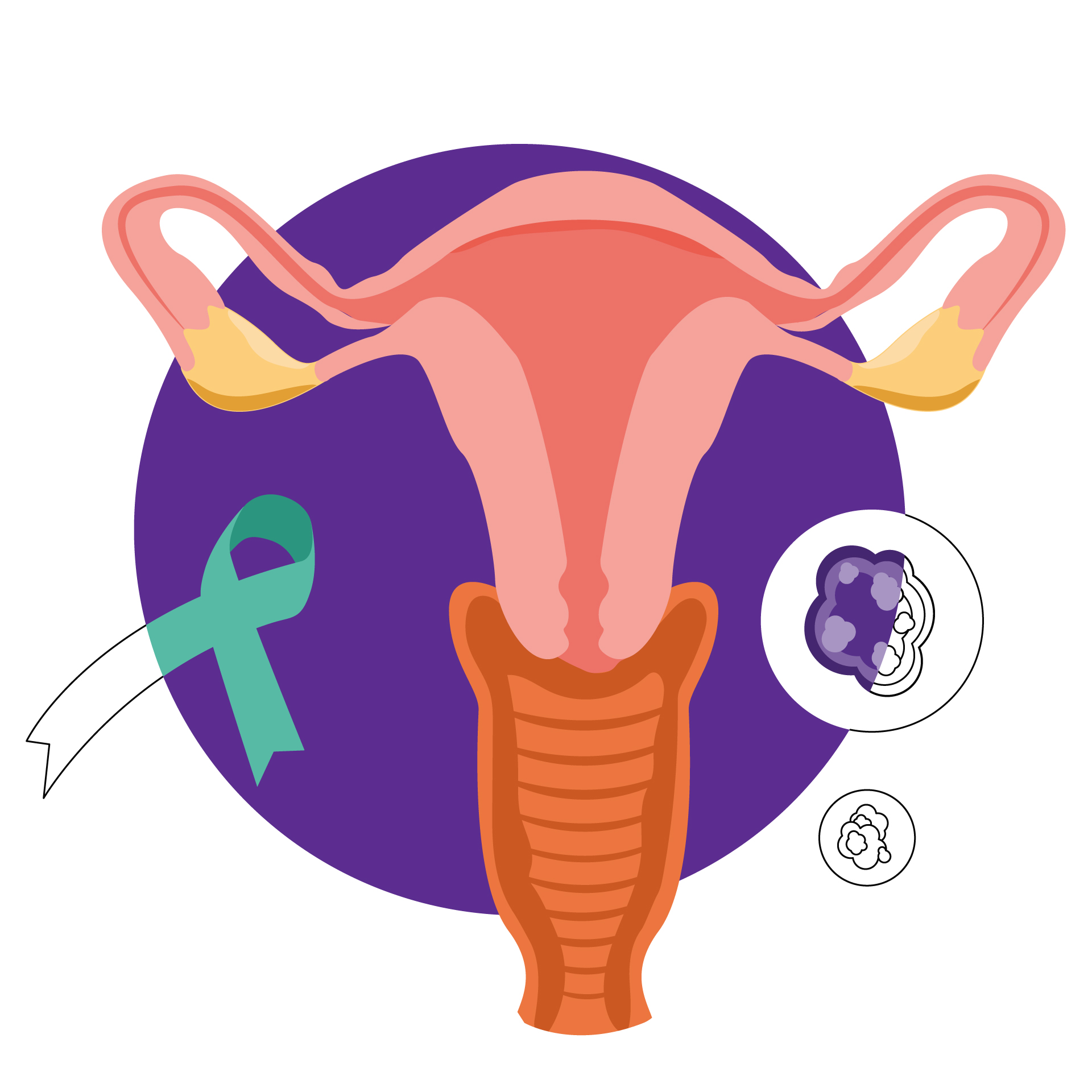 Cervical Cancer: Types, Symptoms & Causes