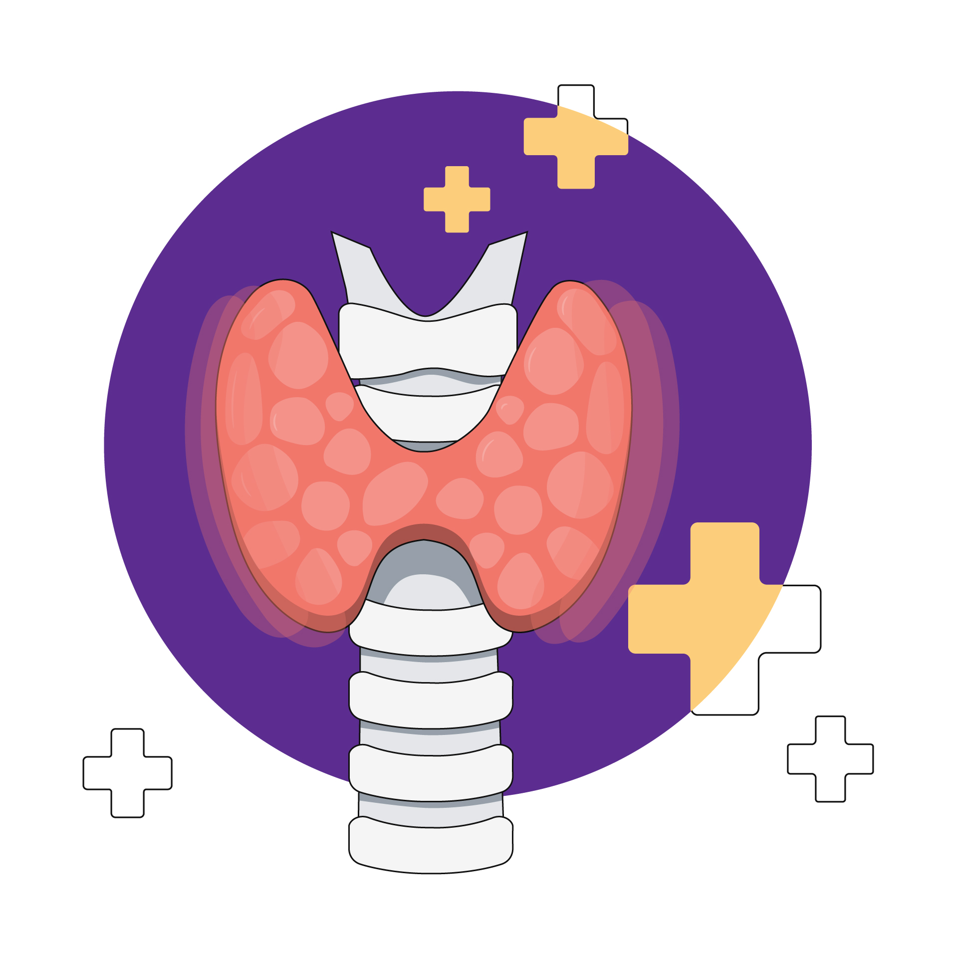 Hypothyroidism (Underactive Thyroid): Causes & Symptoms