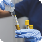 3 Things you need to know about the EtG test