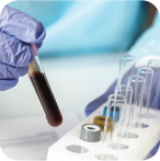 5 Important things about the testosterone test