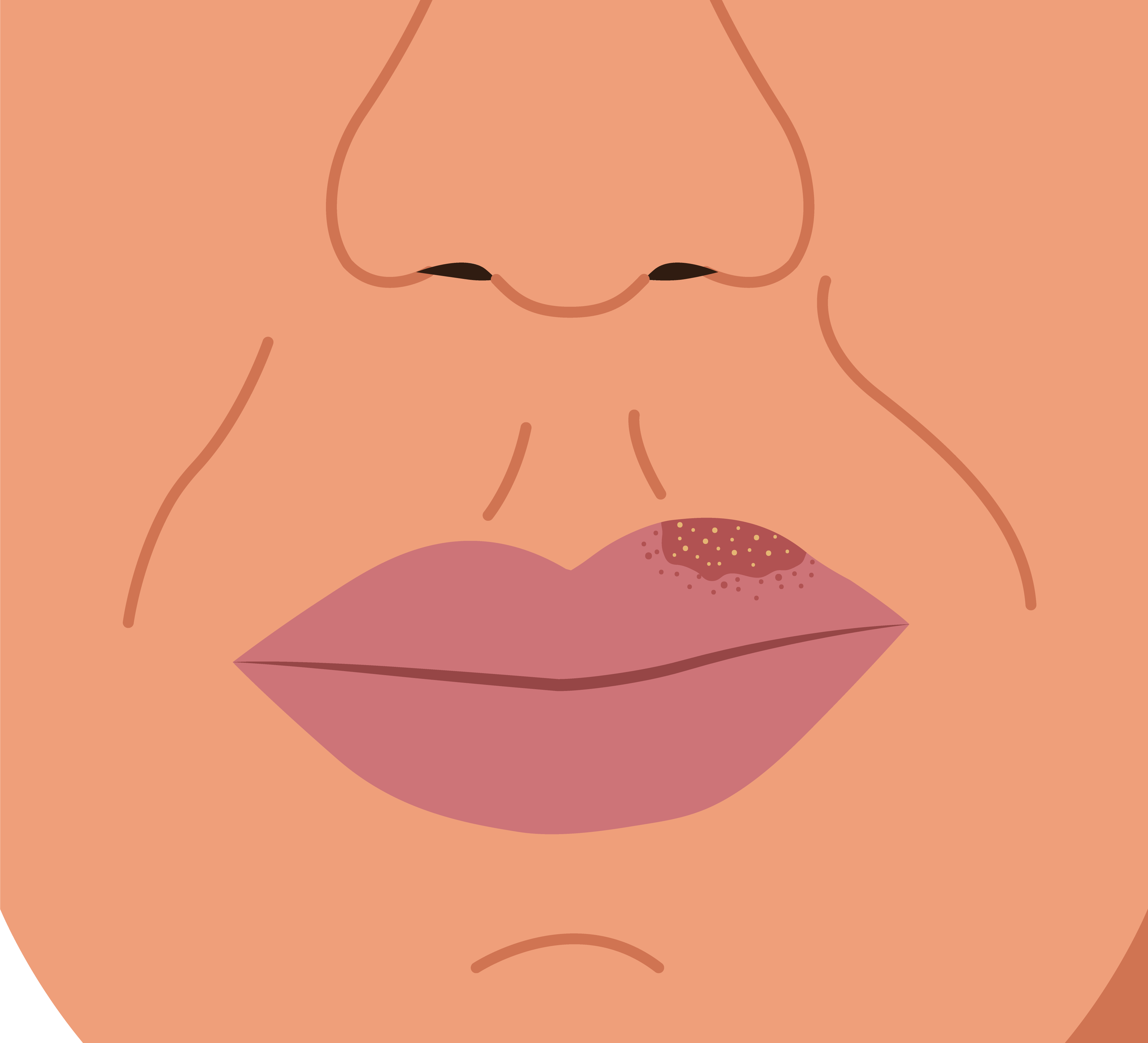 Cold sores Treatment, Causes, symptoms and Diagnosis