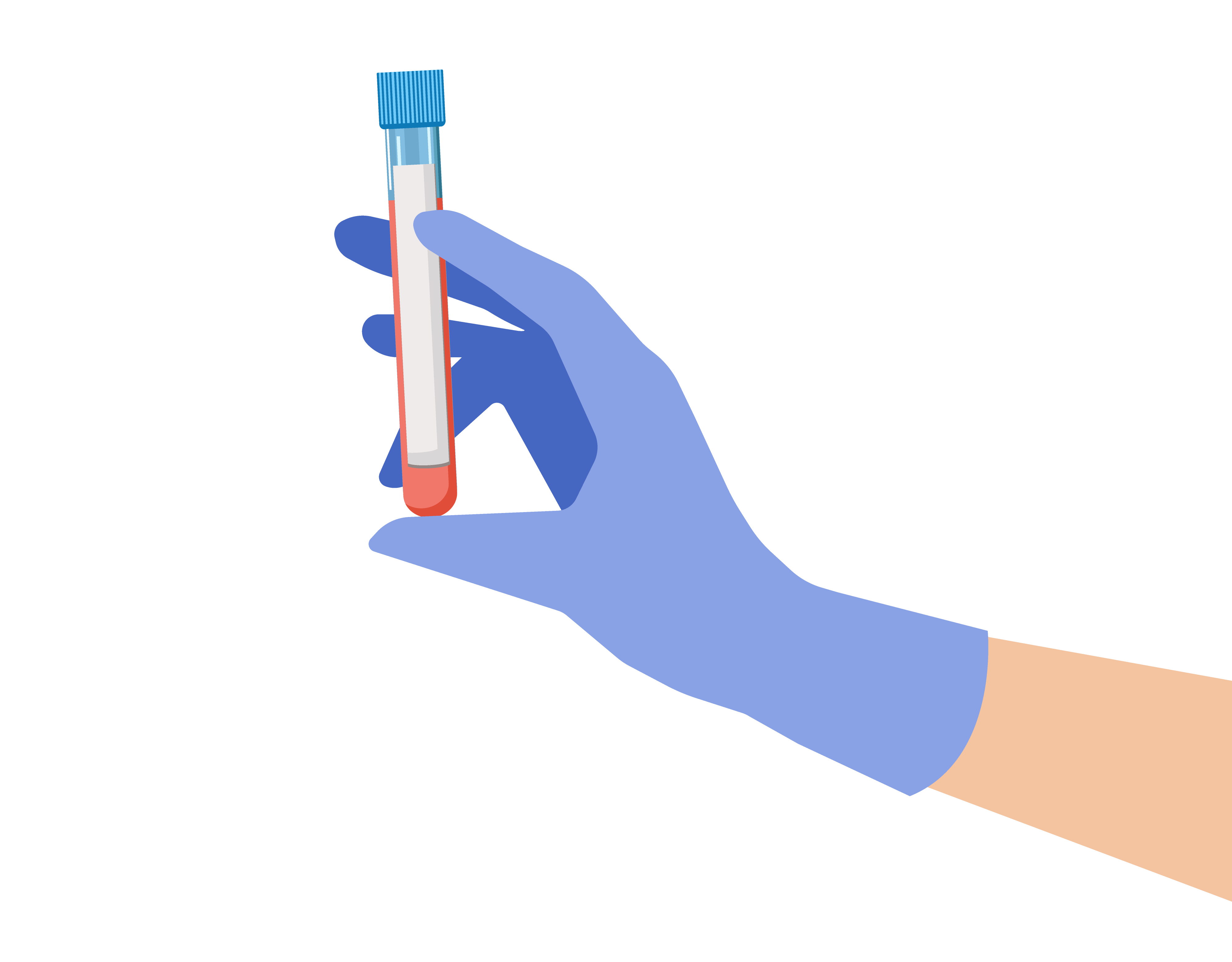 Prostate-specific antigen test: 3 Things to know