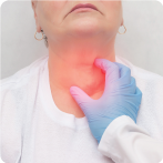 Goiter: Causes, Symptoms, Diagnosis and Treatment