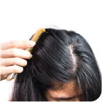 Greasy Hair Treatment: 10 Natural Ways to Get Rid of it