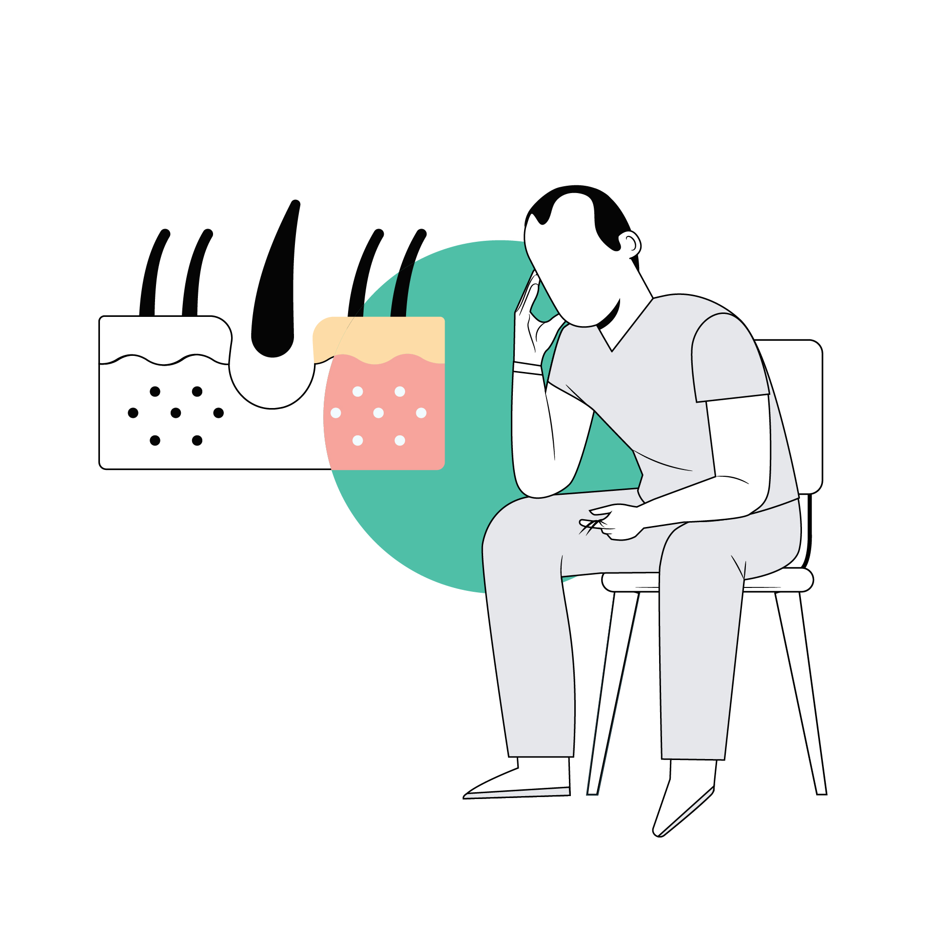 Male Pattern Baldness: Causes, Risk and Treatment Procedures