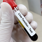 SGPT Normal Range: High Level Causes and Symptoms