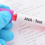 Antinuclear Antibodies Blood Test (ANA): Purpose and Procedure