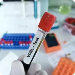 VDRL Test: Means, Procedure, Results and Risk Factor