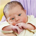 Strabismus (Crossed Eyes): Symptoms, Causes and Treatment