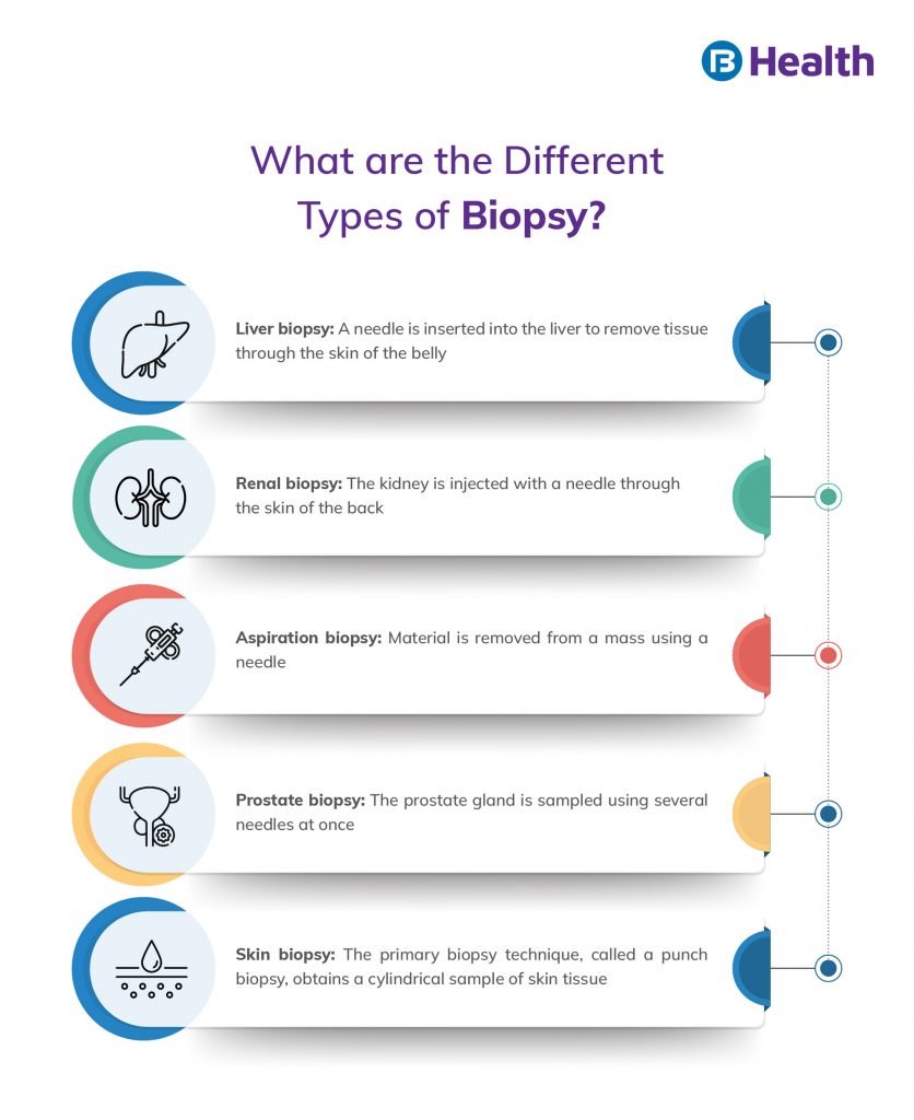 All You Need To Know About a Biopsy