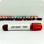 SGOT Normal Range, Test Results, Cost, and More
