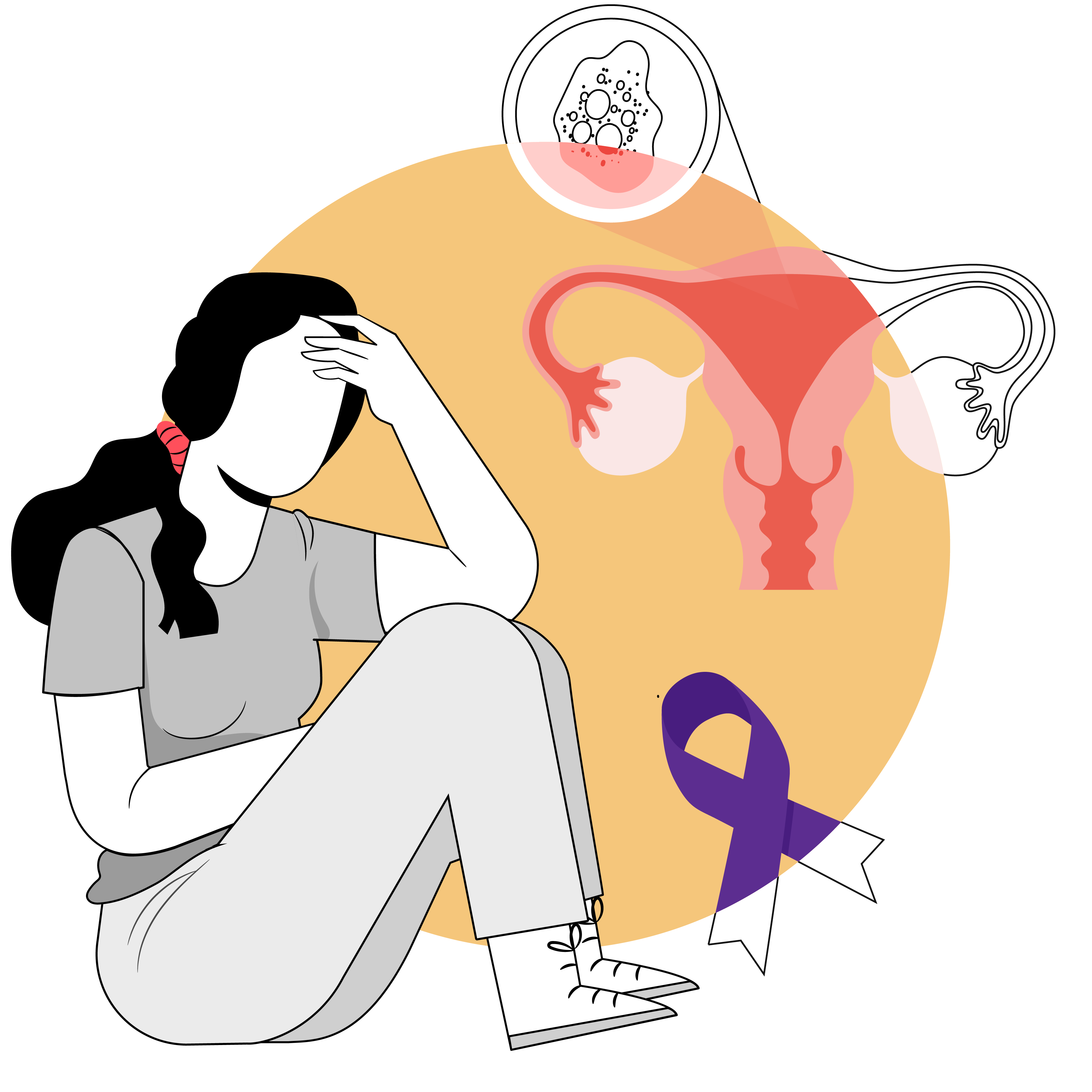 What are the Causes, Symptoms, and Treatment of Vulvar Cancer?