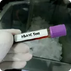 HbA1c Normal Range (Hemoglobin A1c): Procedure, High Level